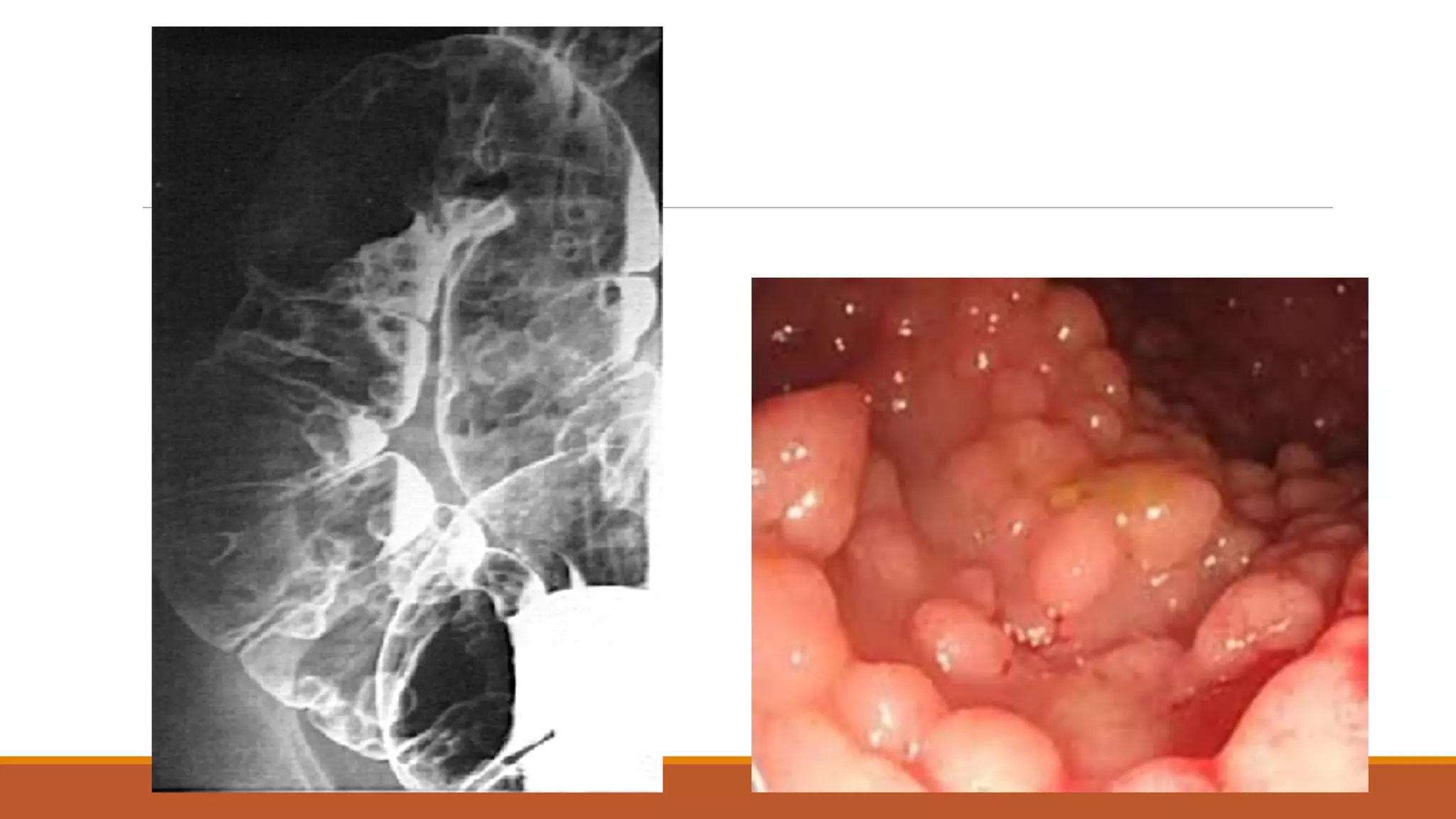 Abdominal radiology pattern recognition | PDF
