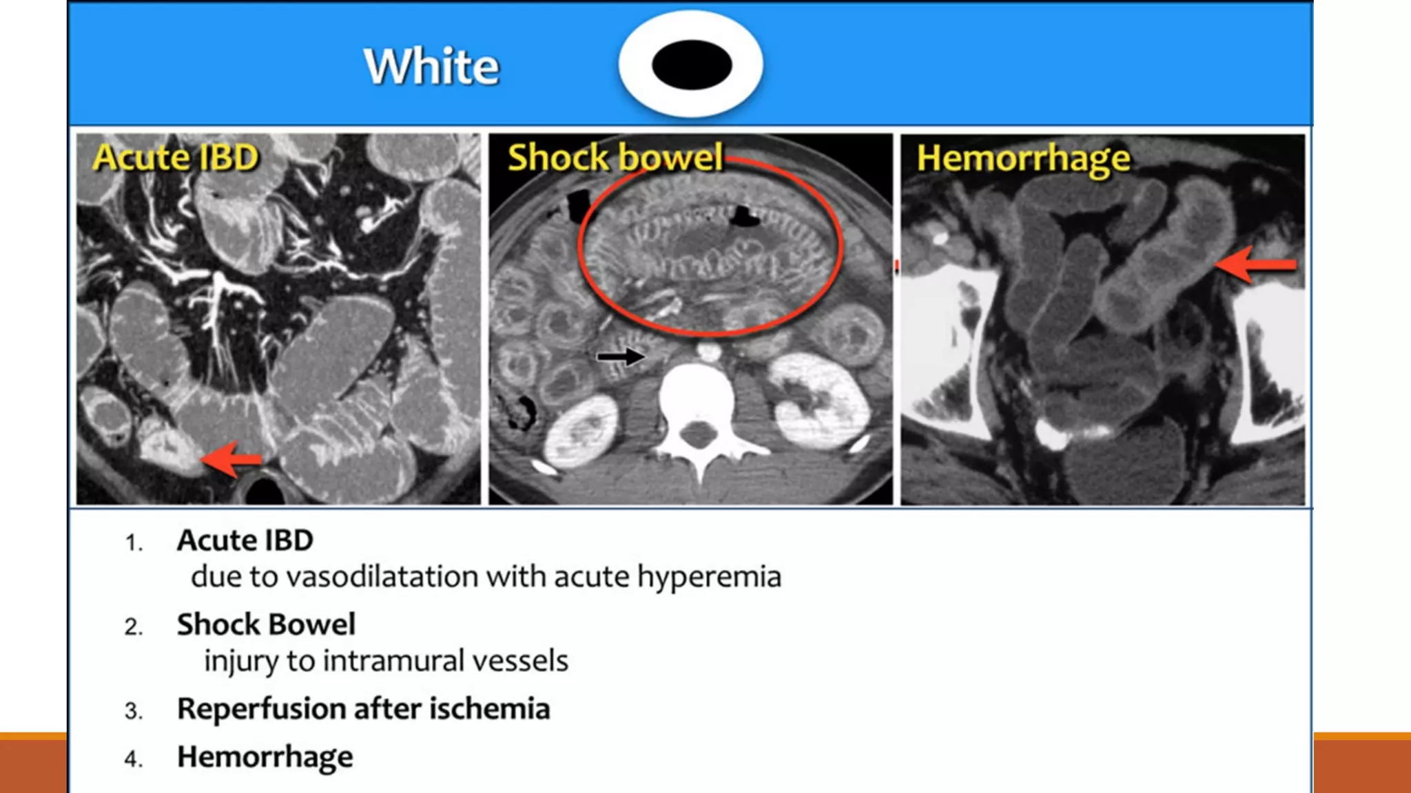 Abdominal radiology pattern recognition | PDF