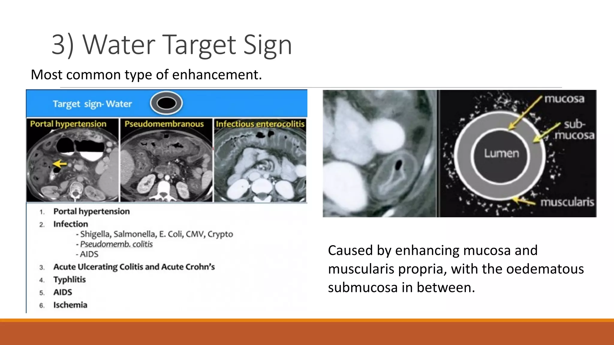 Abdominal radiology pattern recognition | PDF
