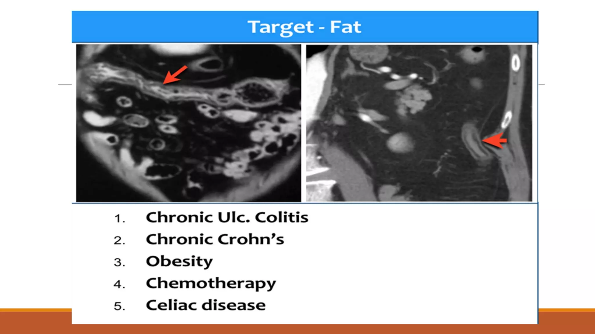 Abdominal radiology pattern recognition | PDF
