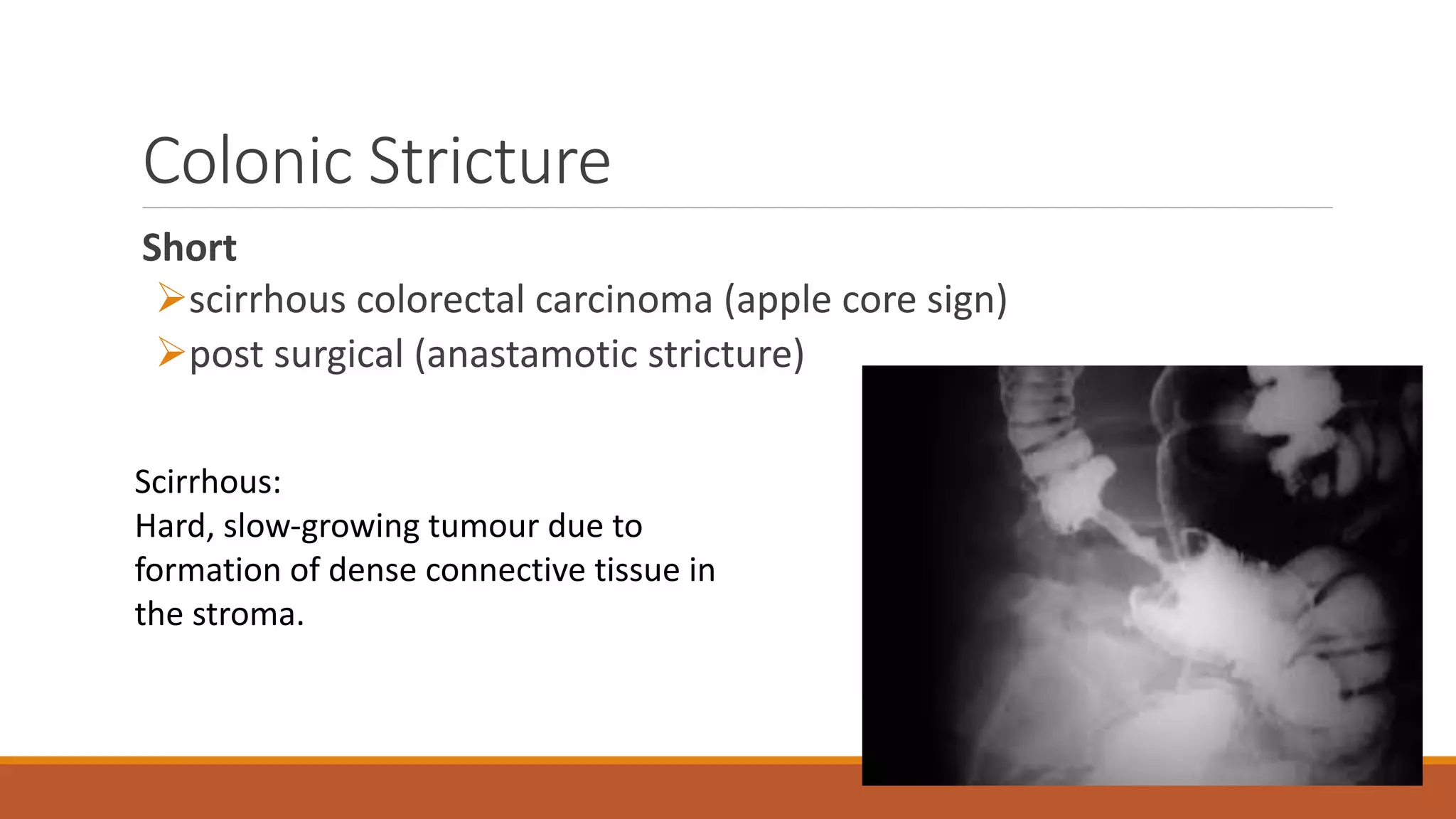Abdominal radiology pattern recognition | PDF