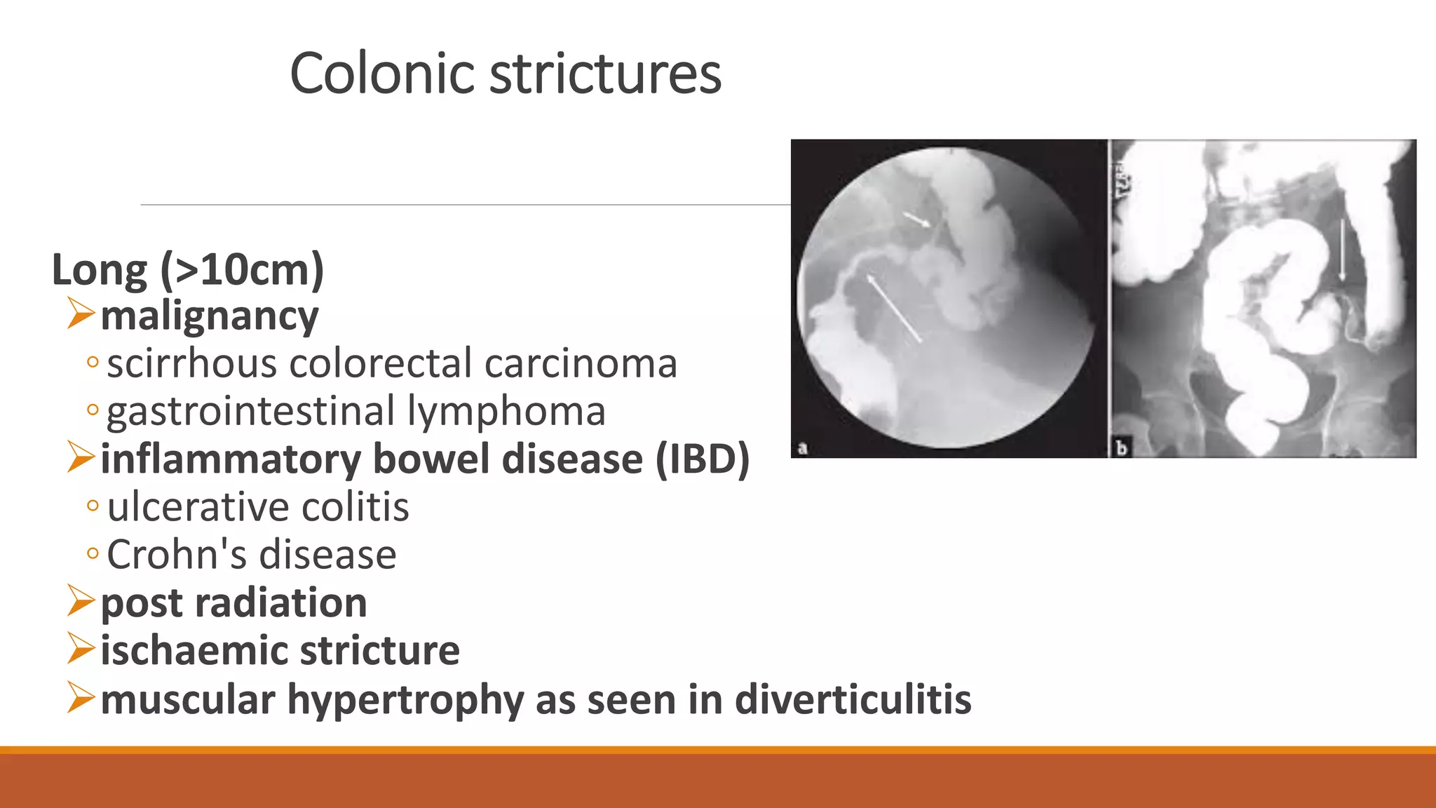 Abdominal radiology pattern recognition | PDF