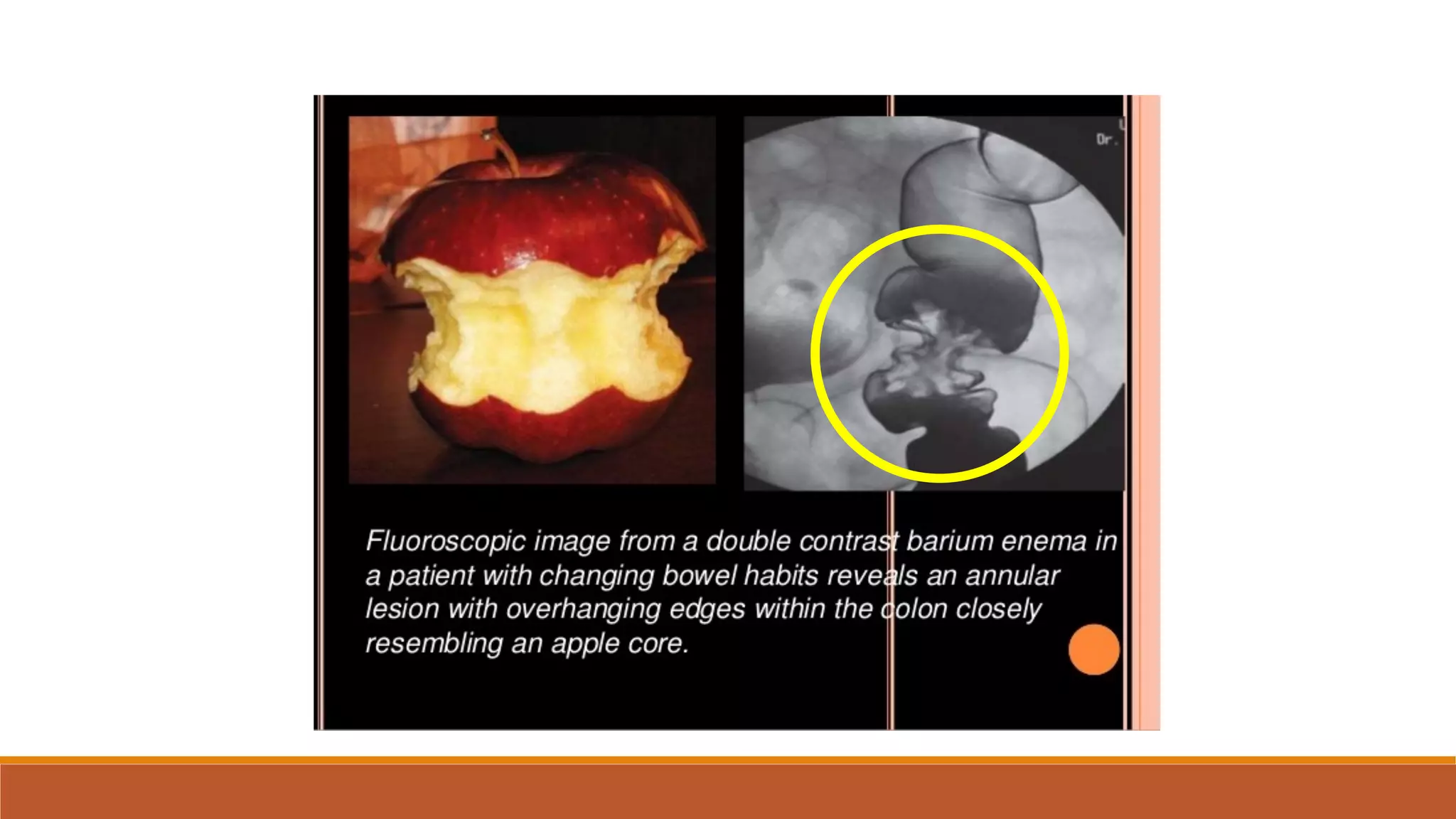 Abdominal radiology pattern recognition | PDF