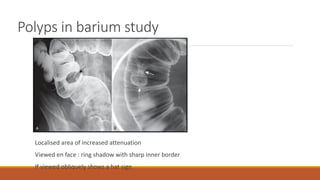 Abdominal radiology pattern recognition | PDF