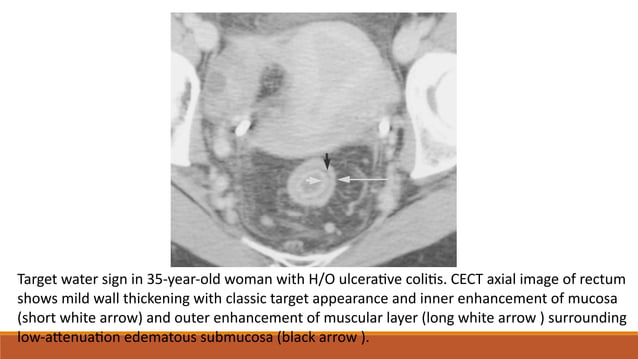Abdominal radiology pattern recognition | PDF