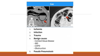 Abdominal radiology pattern recognition | PDF