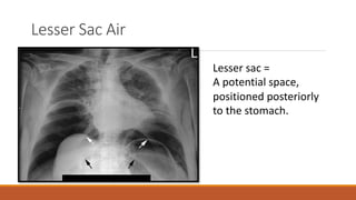 Abdominal radiology pattern recognition | PDF