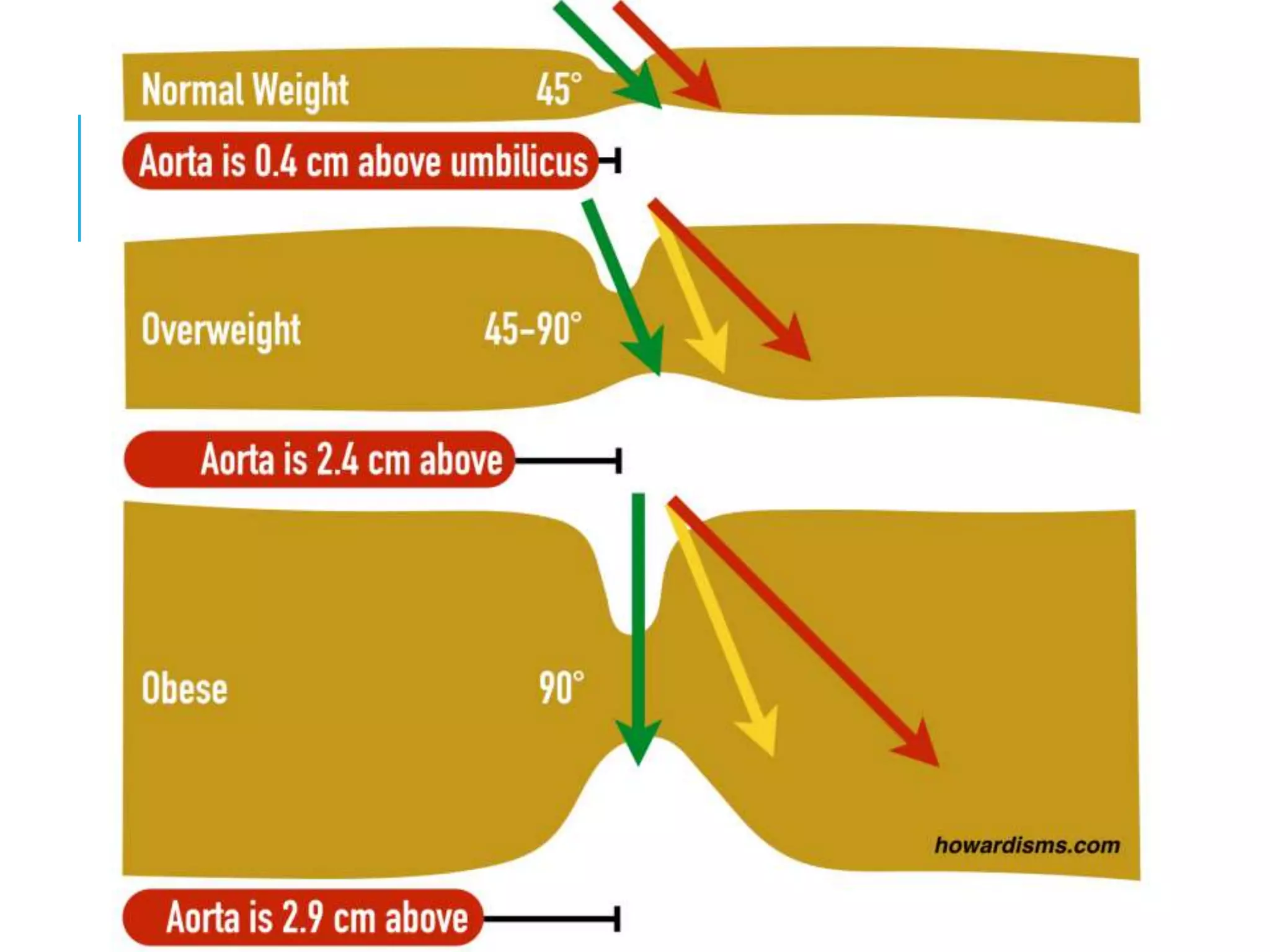 Abdomen surface marking and radiology | PPTX