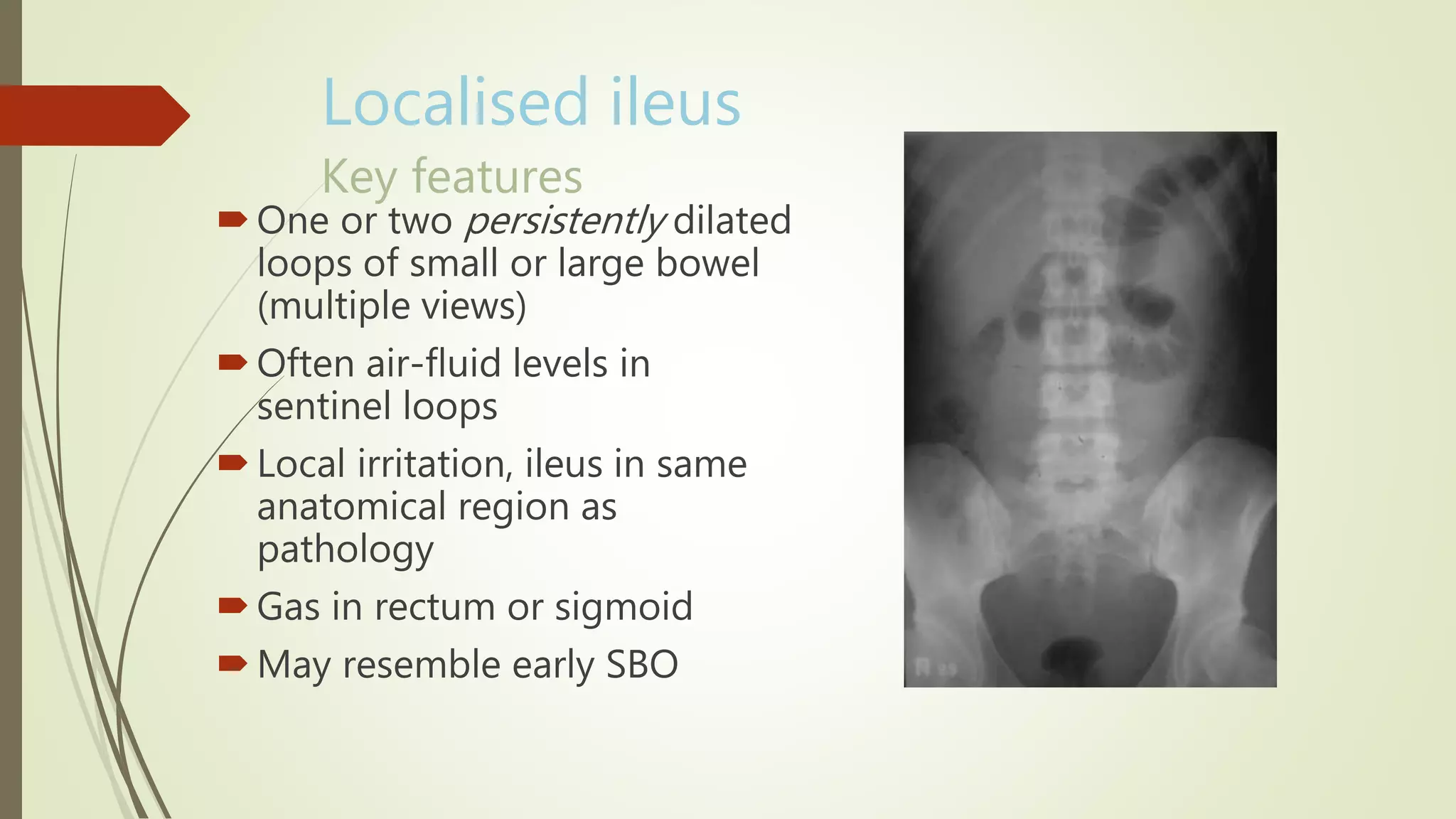 Abdominal x-ray interpretation ppt | PPTX