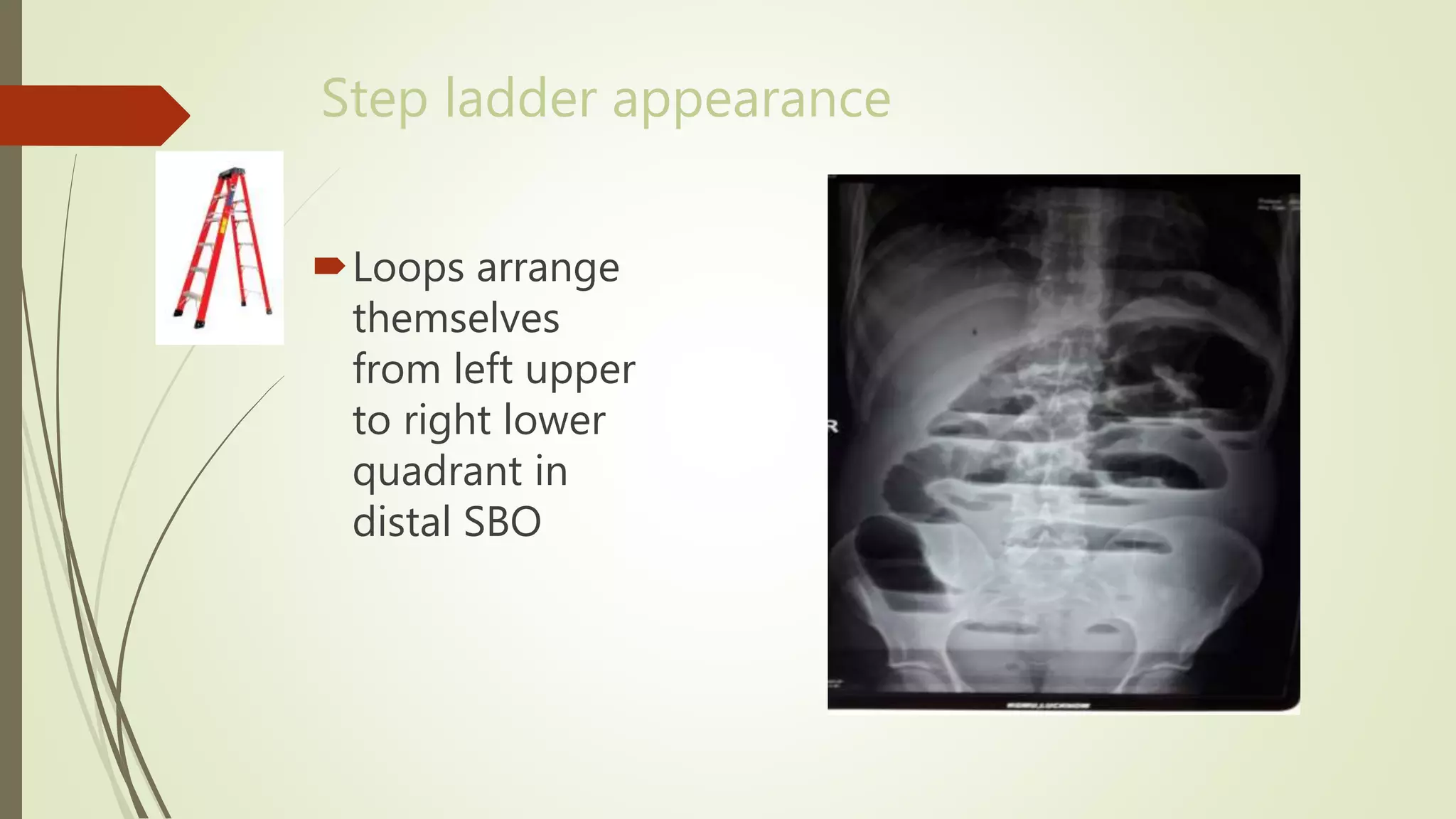 Abdominal x-ray interpretation ppt | PPTX