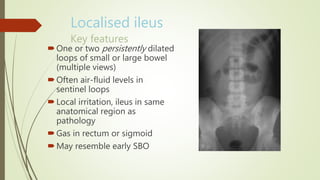 Abdominal x-ray interpretation ppt | PPTX