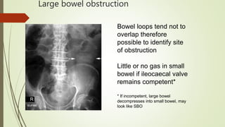 Abdominal x-ray interpretation ppt | PPTX