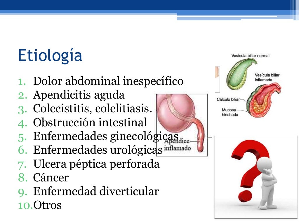 Apendicitis Aguda Y Abdomen Agudo Enarm Theme Route – Bilarasa Apendicitis Aguda Y Abdomen Agudo Enarm Theme Route – Bilarasa