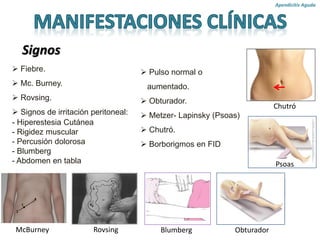 ABDOMEN AGUDO, APENDICITIS Y PERITONITIS | PDF