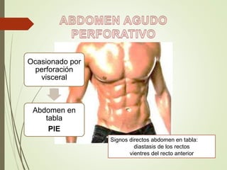 abdomen agudo medico quirurgico agudopd | PPTX