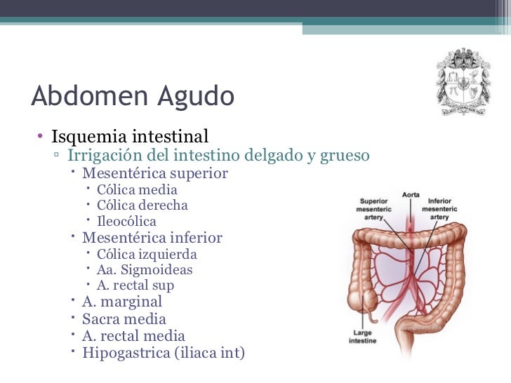 Abdomen agudo obstrucción intestinal e isquemia intestinal