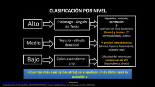 Abdomen agudo Radiología | PPTX