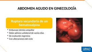 ABDOMEN AGUDO ENFERMEDAD PÉLVICA INFLAMATORIA | PPTX