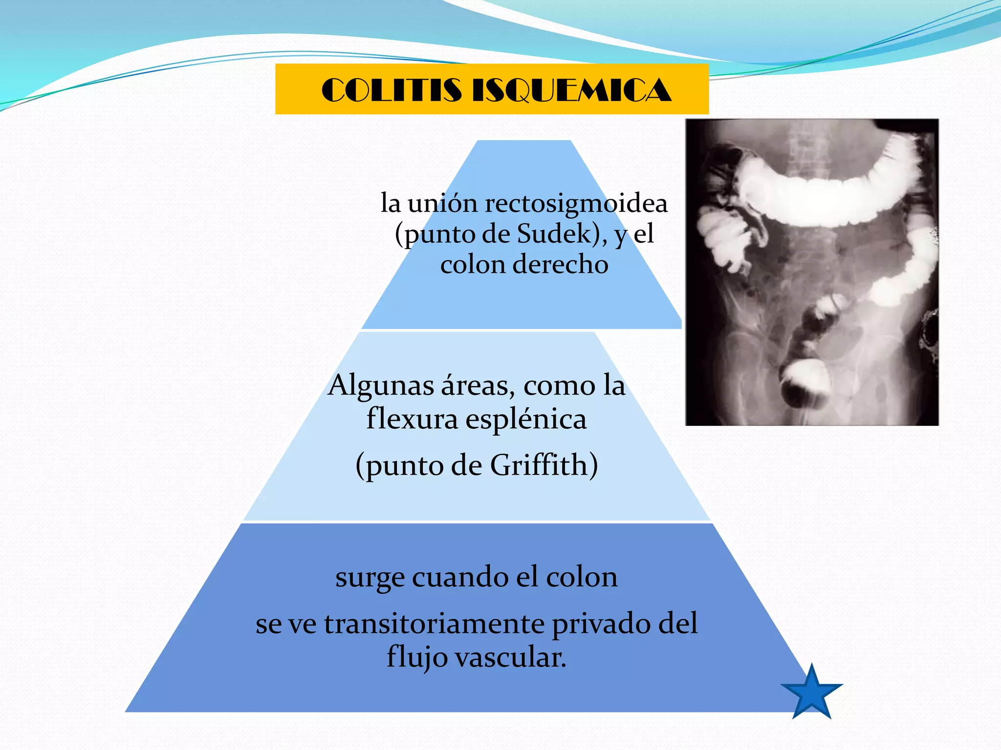 Abdomen Agudo Hemorrágico Vascular | PPTX
