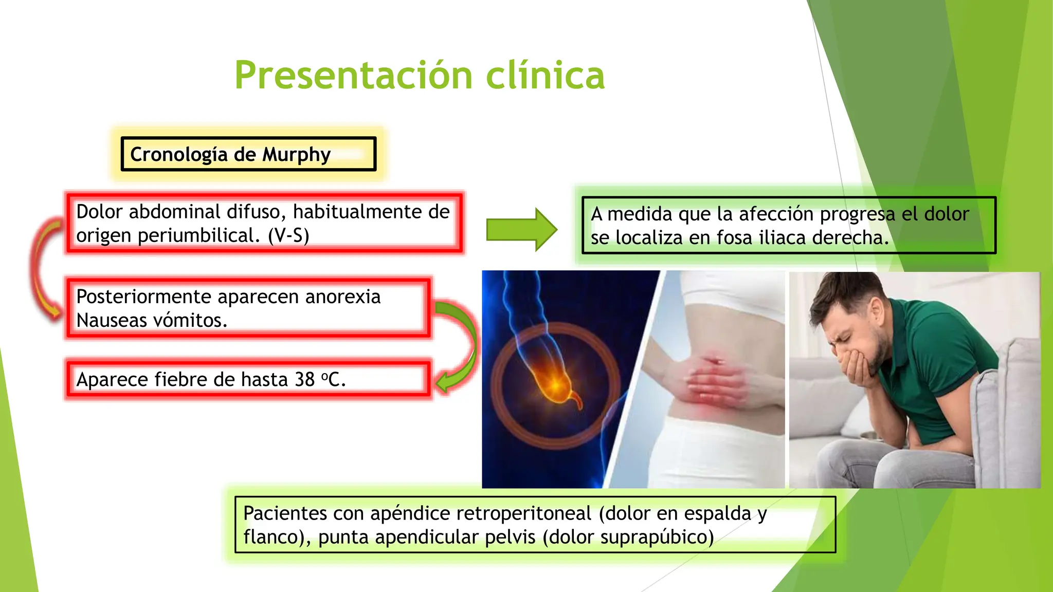 Abdomen agudo inflamatorio - Apendicitis.pptx