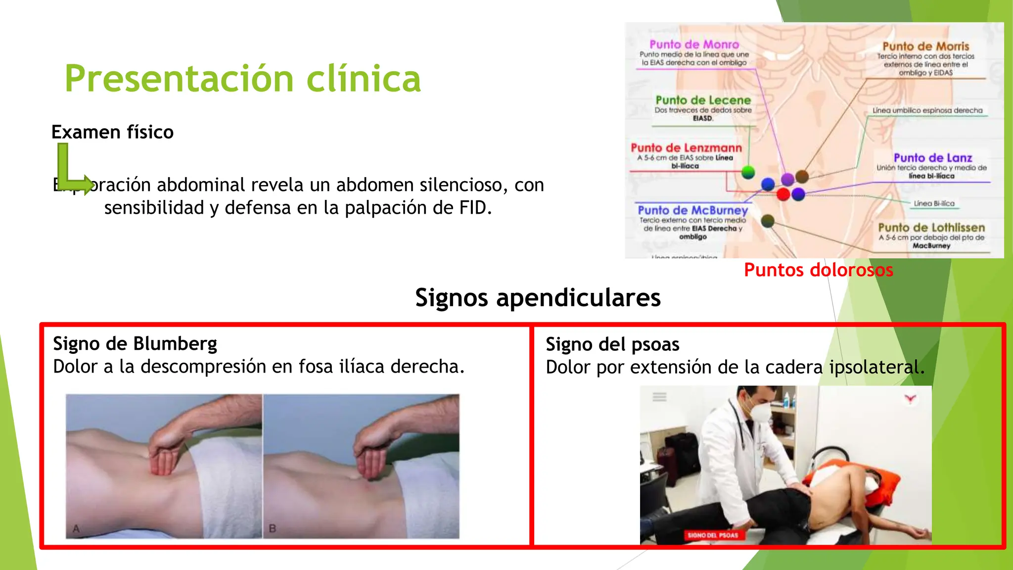 Abdomen agudo inflamatorio - Apendicitis.pptx