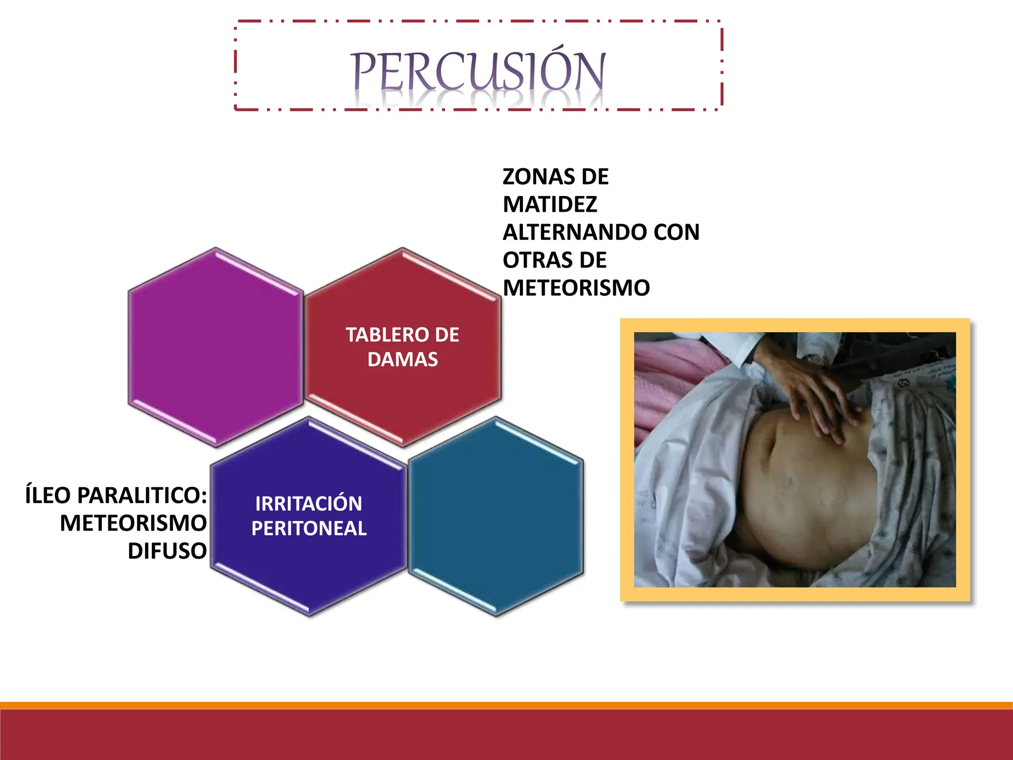 fisiopatologia de abdomen agudo obstructivo.pptx