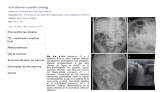 ABDOMEN AGUDO QUIRURGICO EN PEDIATRIA .pptx
