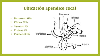 Abdomen agudo y apendicitis aguda | PPT