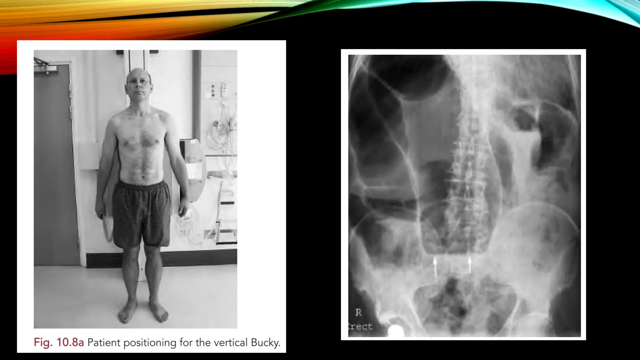 Abdomen and pelvis radiography in practise .ptx