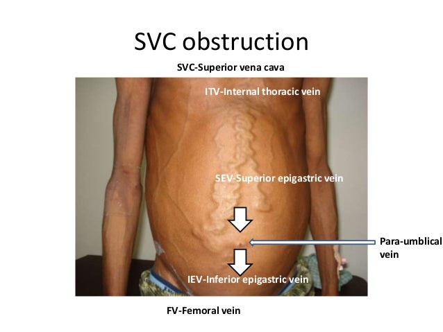 A good PG case presentation on abdominal case, liver