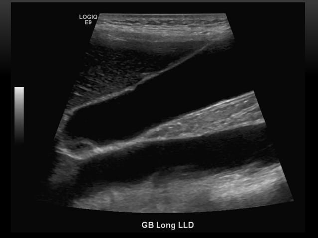 Abdomen Complete US Protocol 10-29-15.pptx