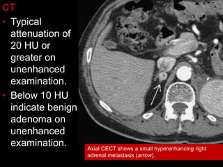 Abdomen ct patho 3 | PPTX