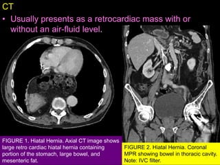 Abdomen ct patho 3 | PPTX