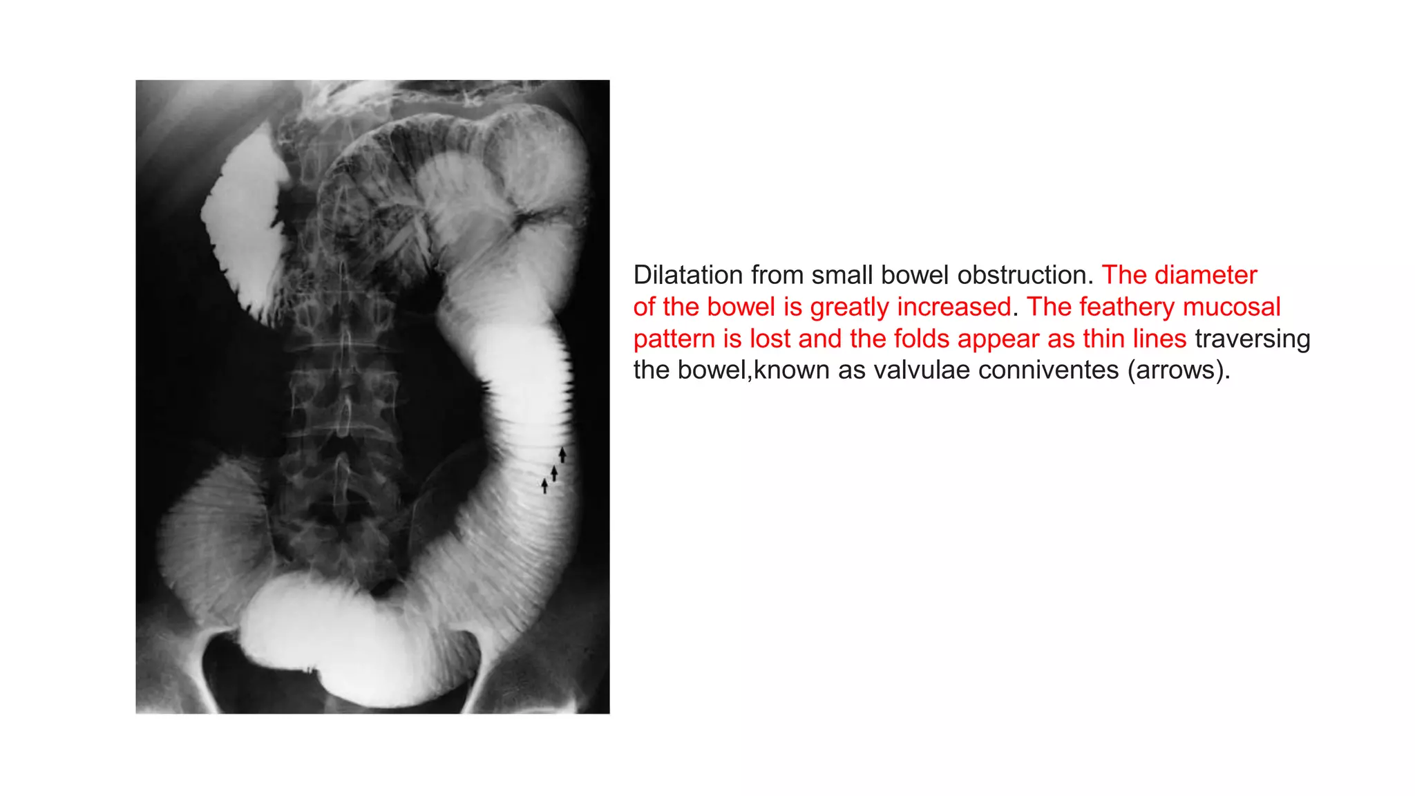 Abdomen Gastrointestinal tract.pptx
