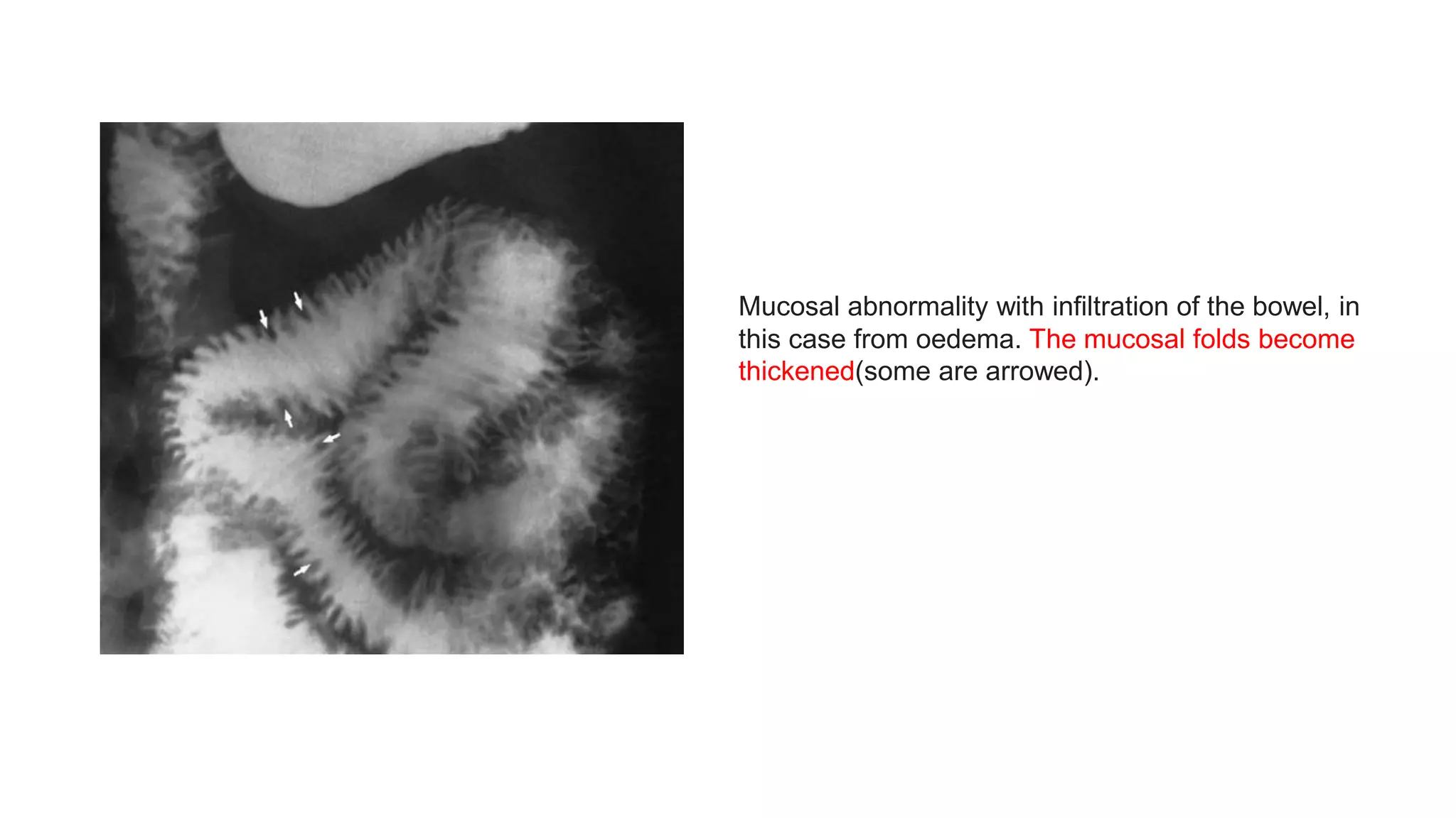 Abdomen Gastrointestinal tract.pptx
