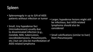 Abdomen gjeneral.pptx