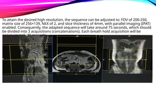 Abdomen MRI Protocol Planing.pptx Abdomen MRI Protocol Planing.pptx