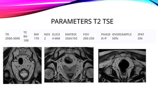 Abdomen MRI Protocol Planing.pptx Abdomen MRI Protocol Planing.pptx