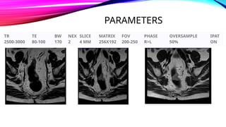 Abdomen MRI Protocol Planing.pptx Abdomen MRI Protocol Planing.pptx