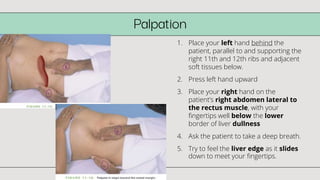 abdomen PE.pptx
