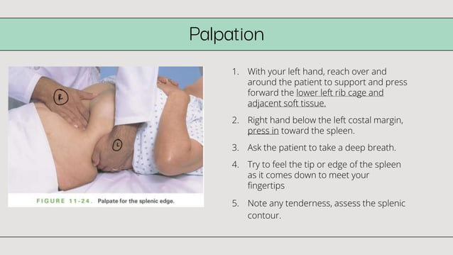 abdomen PE.pptx | Digestive Disorders | Diseases and Conditions