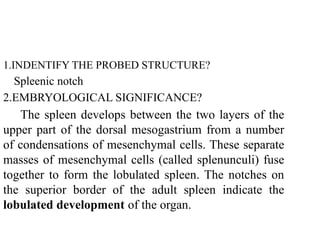 Mmc ioa ABDOMEN & PELVIS SPOTTERS I.pptx