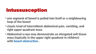 Abdomen Radiographic detailed evaluation.pptx