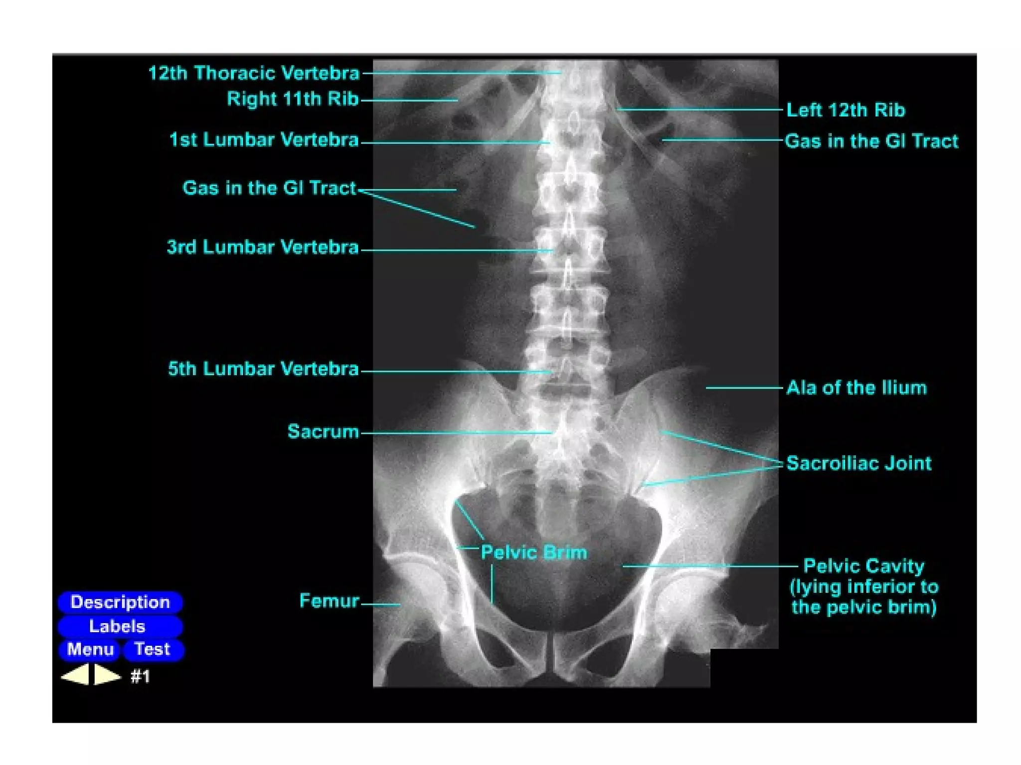 Abdomen radiography | PPT