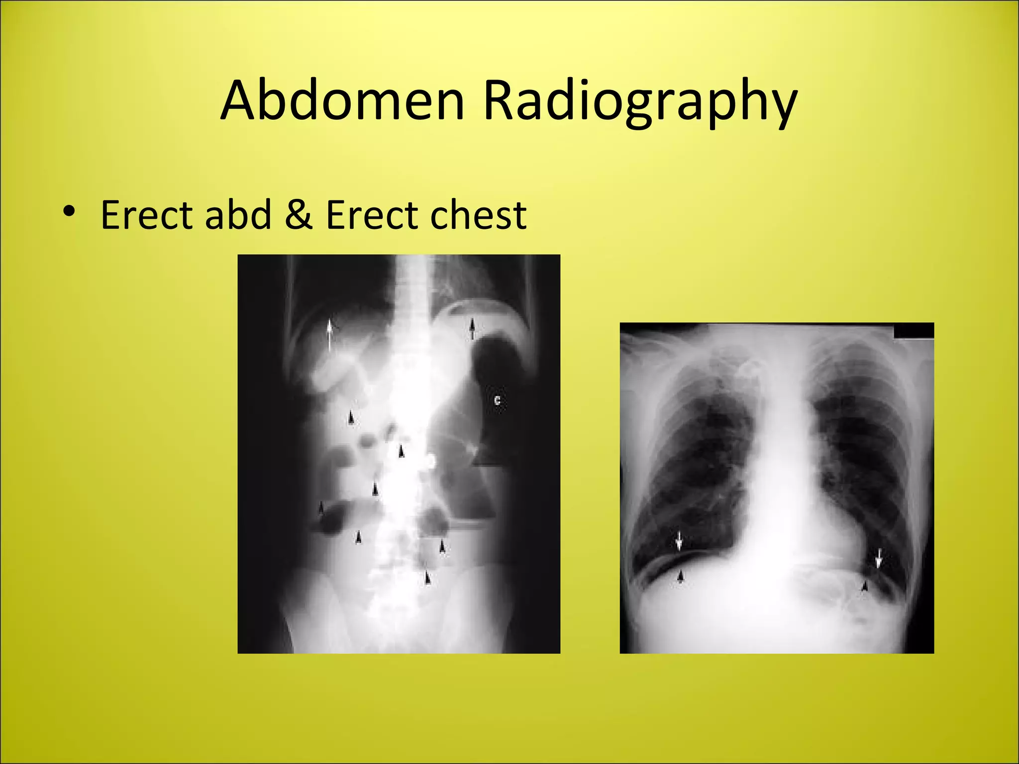 Abdomen Radiography ppt . Daniel J.P. Radiology Technologist ...