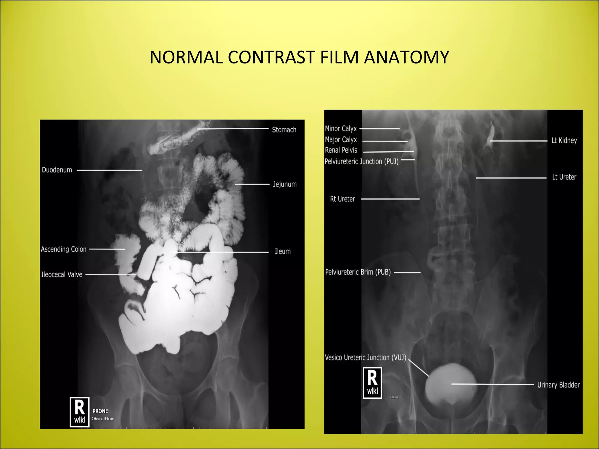 Abdomen Radiography ppt . Daniel J.P. Radiology Technologist ...