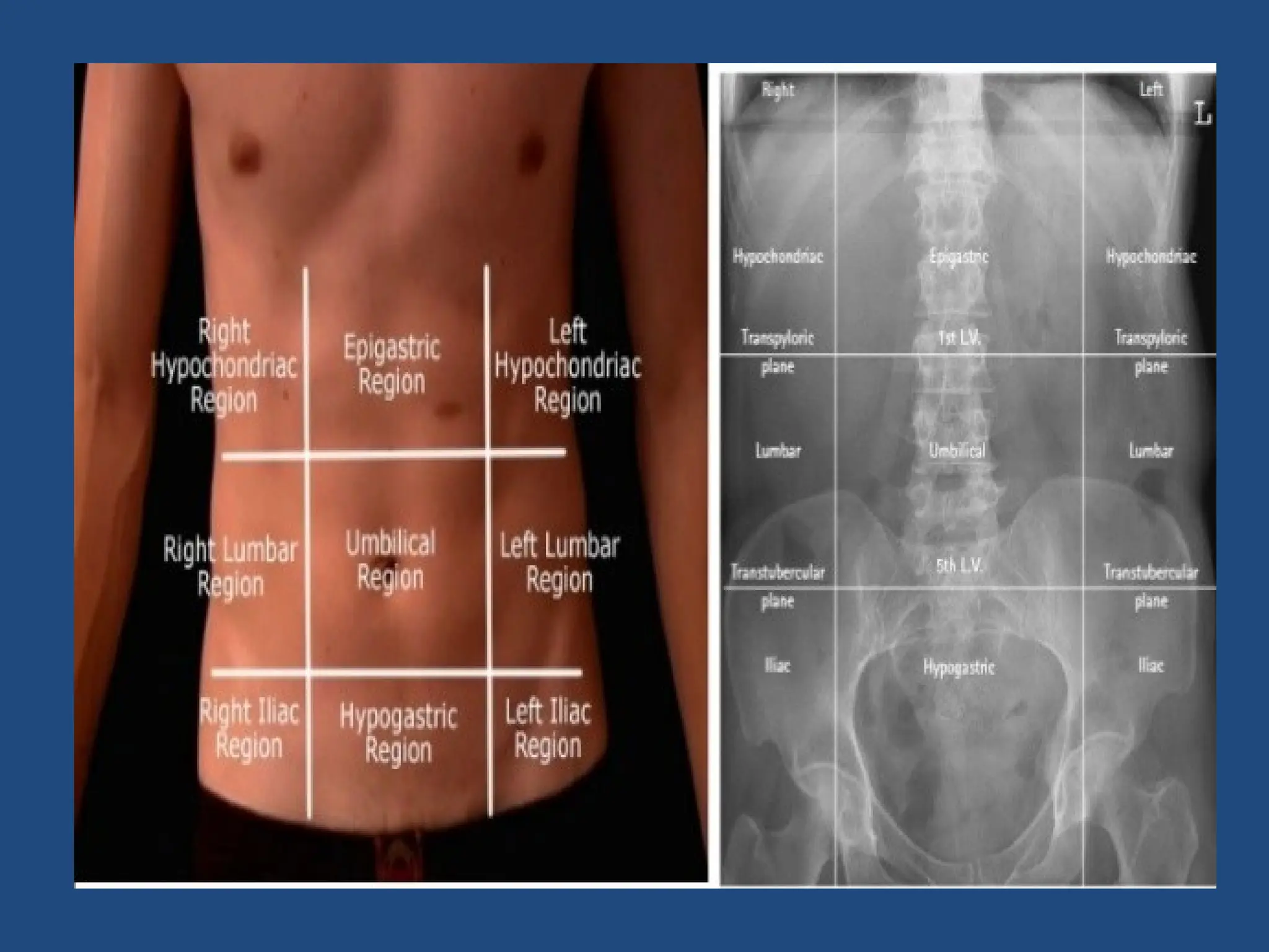 Abdomen Radiography and Pelvimetry - Poj | PPTX