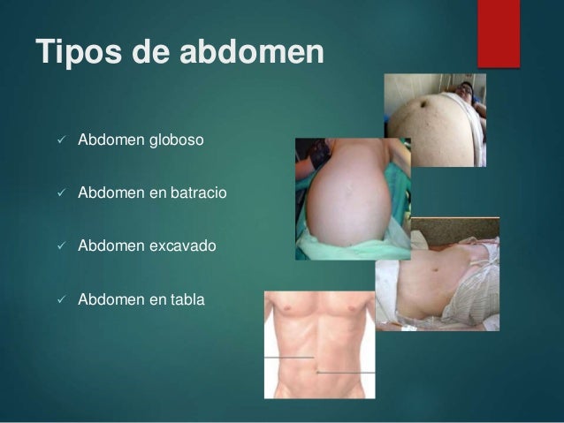 Abdomen Presentacion Grupo 4 Semiologia 2014