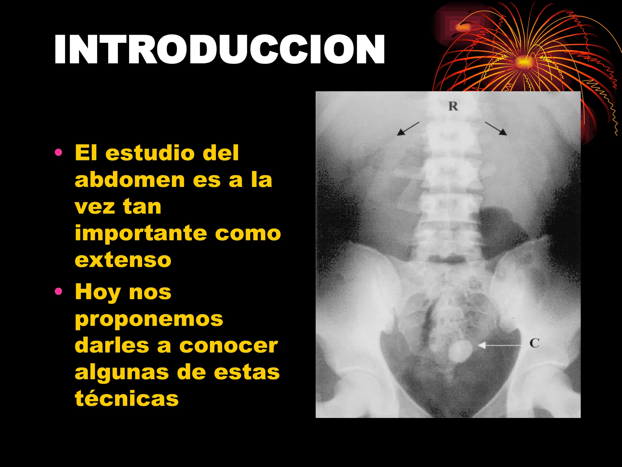 ABDOMEN SIMPLE. Importante ... Abdomen simple | PPT | Death, Injury, or ...