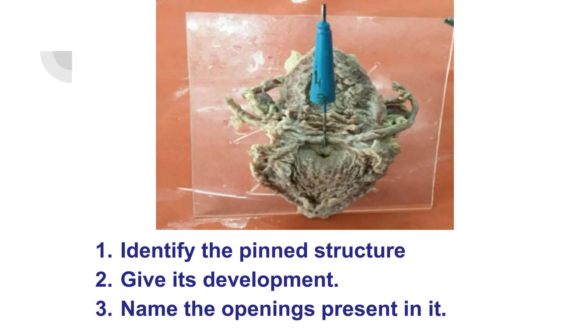 ABDOMEN ANATOMY SPOTTERS REVISION FOR FIRST MBBS.pptx